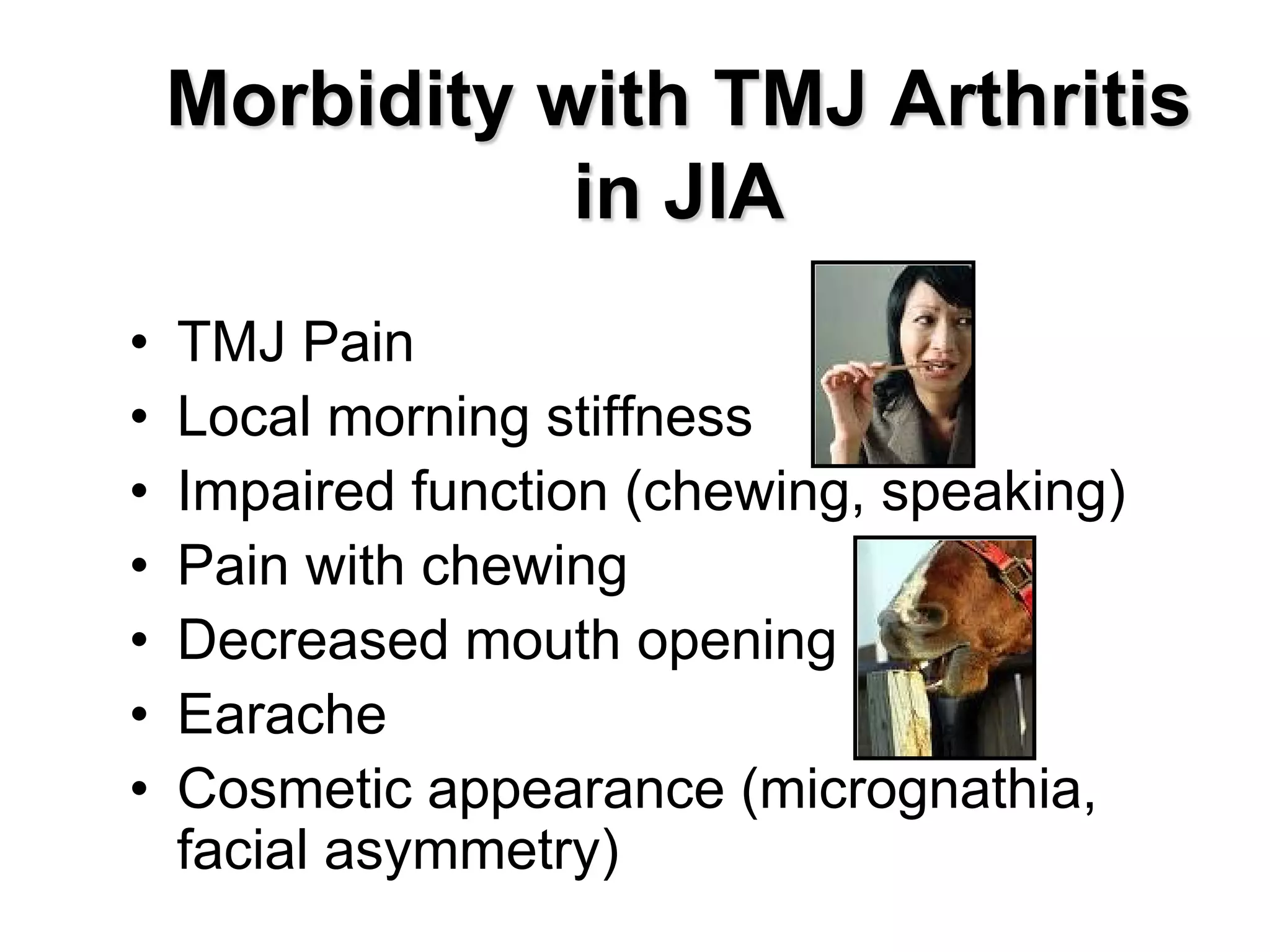 Temporomandibular Joint Arthritis in Pediatric Inflammatory ...