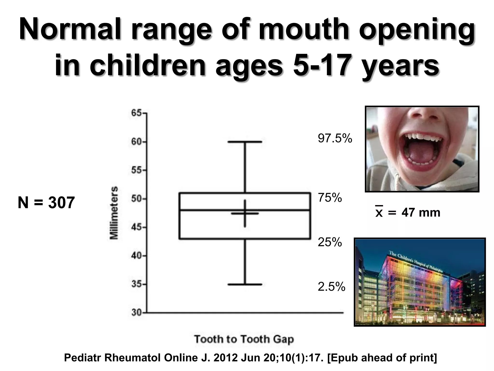 Temporomandibular Joint Arthritis in Pediatric Inflammatory ...