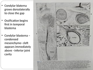 temporomandibular joint. Structure and functions.pptx
