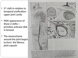 temporomandibular joint. Structure and functions.pptx