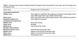 TMR in amputations | PPTX