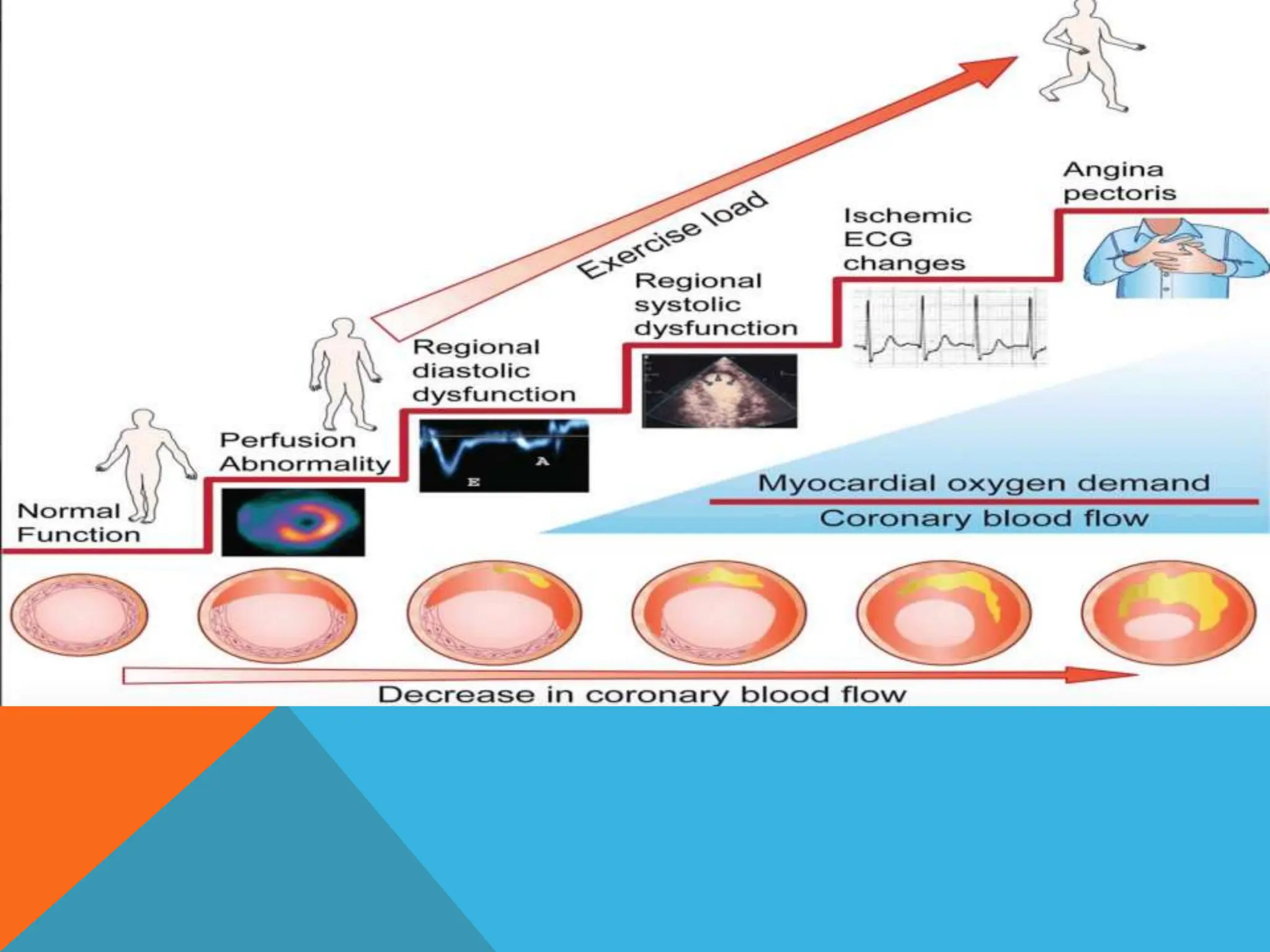 Treadmill stress testing | PPTX