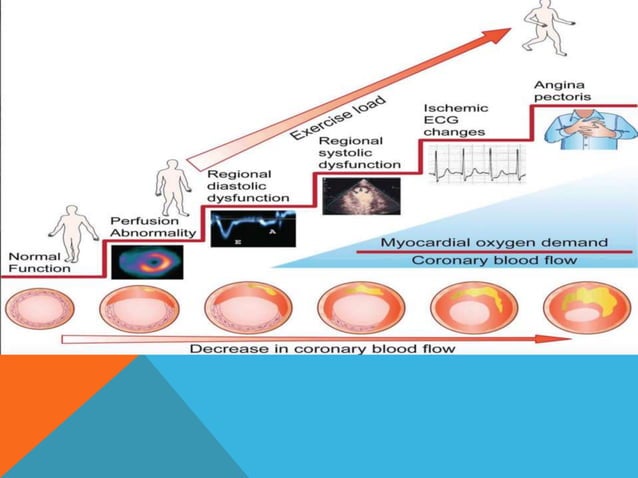 Treadmill stress testing | PPTX