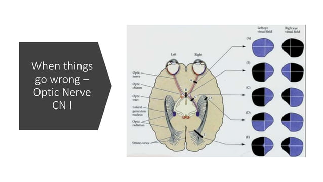 TMTS Cranial Nerves Powerpoint.pptx