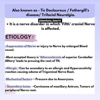 Trigeminal Neuralgia | PDF