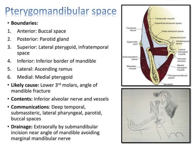 facial spaces in maxillofacial region.pptx