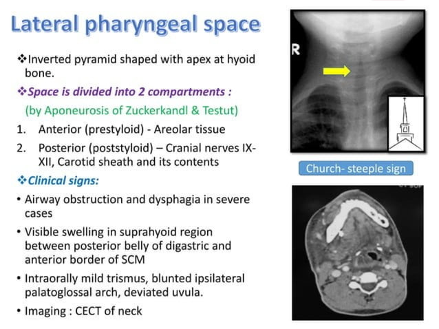 facial spaces in maxillofacial region.pptx