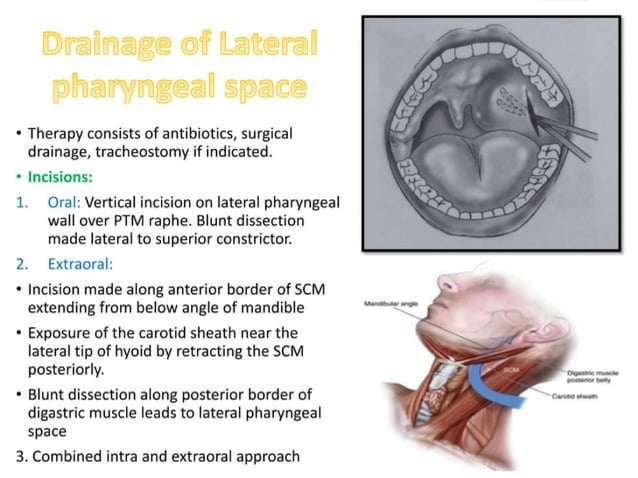 facial spaces in maxillofacial region.pptx