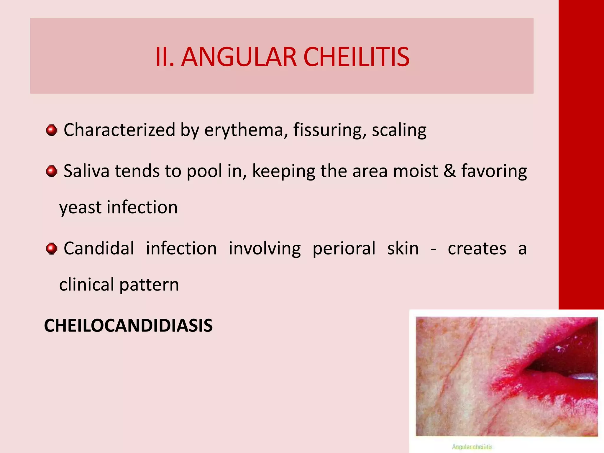 red and white lesions of oral cavity | PPTX