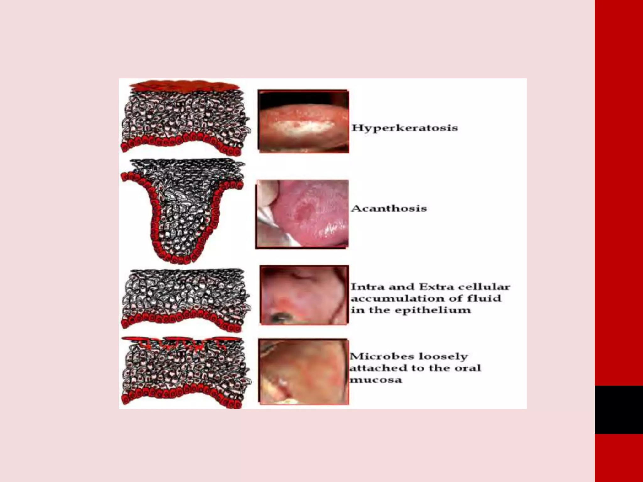 red and white lesions of oral cavity | PPTX