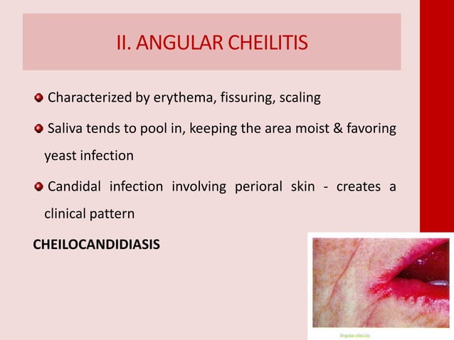 red and white lesions of oral cavity | PPTX