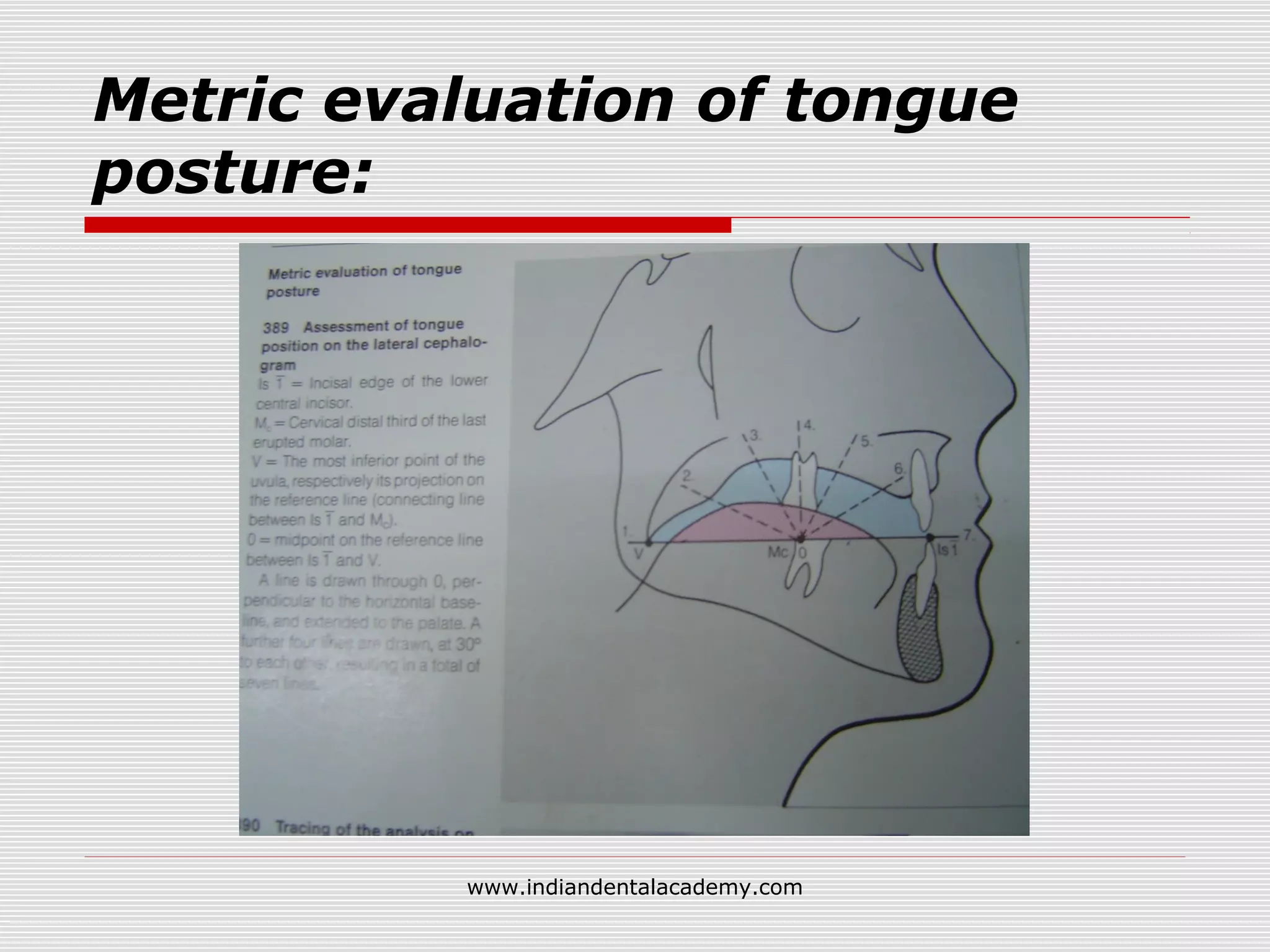 Tongue and its importance in orthodontic treatment /certified fixed ...