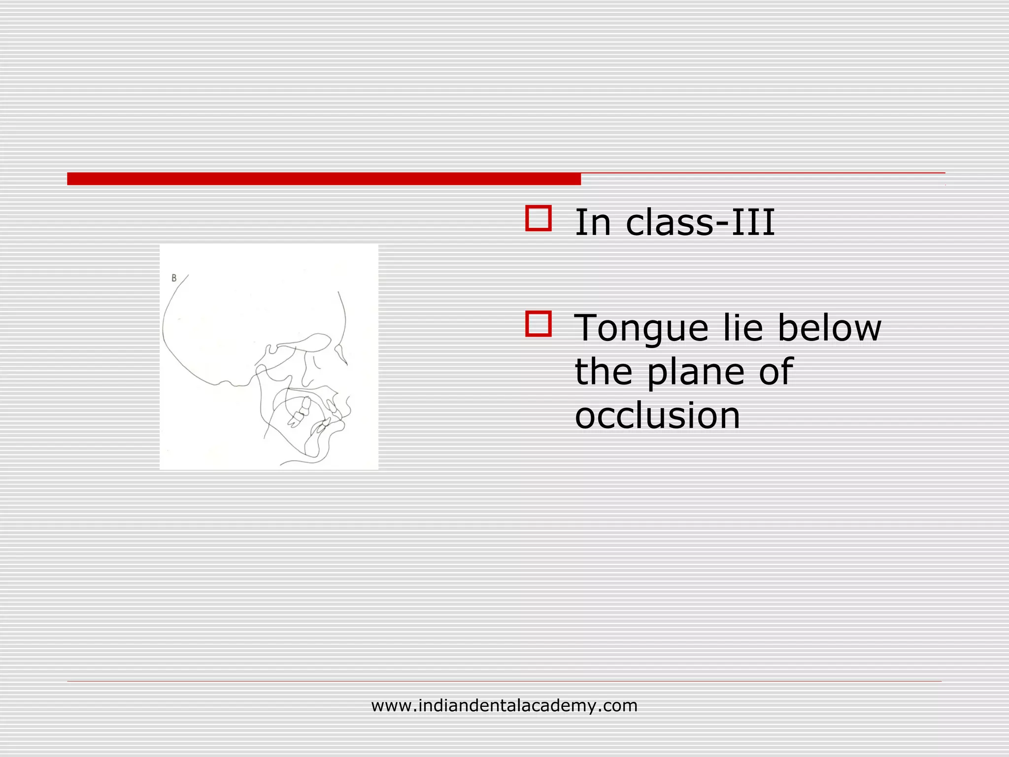 Tongue and its importance in orthodontic treatment /certified fixed ...