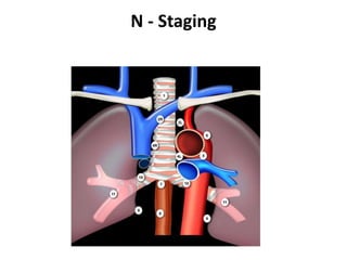 bronchogenic carcinoma TNM-8 edition | PPTX
