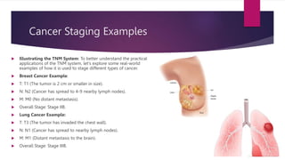 TNM Classification and Implication to Cancer Staging.pptx