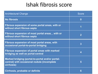 TNM Classification for Hepatocellular Carcinoma.pptx