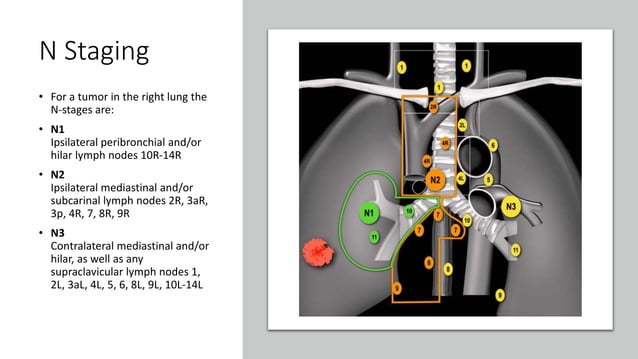 TNM lung presentation.pptx