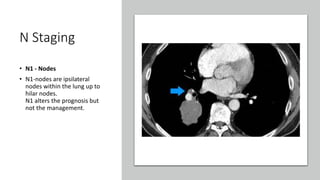 TNM lung presentation.pptx