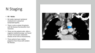 TNM lung presentation.pptx