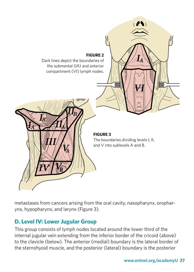 TNM staging of head neck cancer | PDF