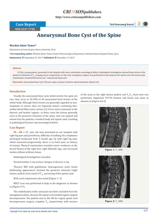 Aneurysmal Bone Cyst of the Spine | Crimson Publishers | PDF