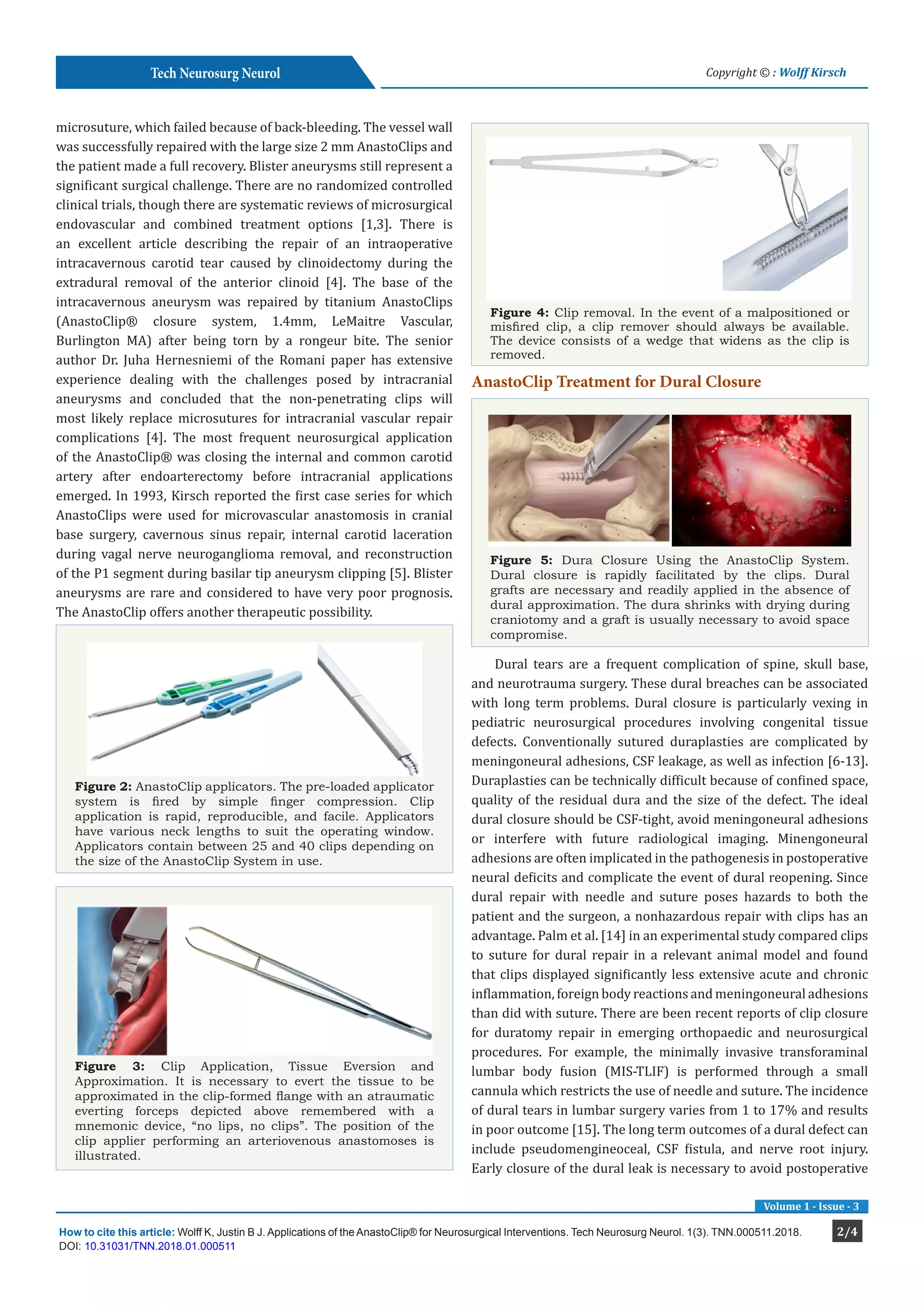 Applications of the AnastoClip® for Neurosurgical Interventions_Crimson ...