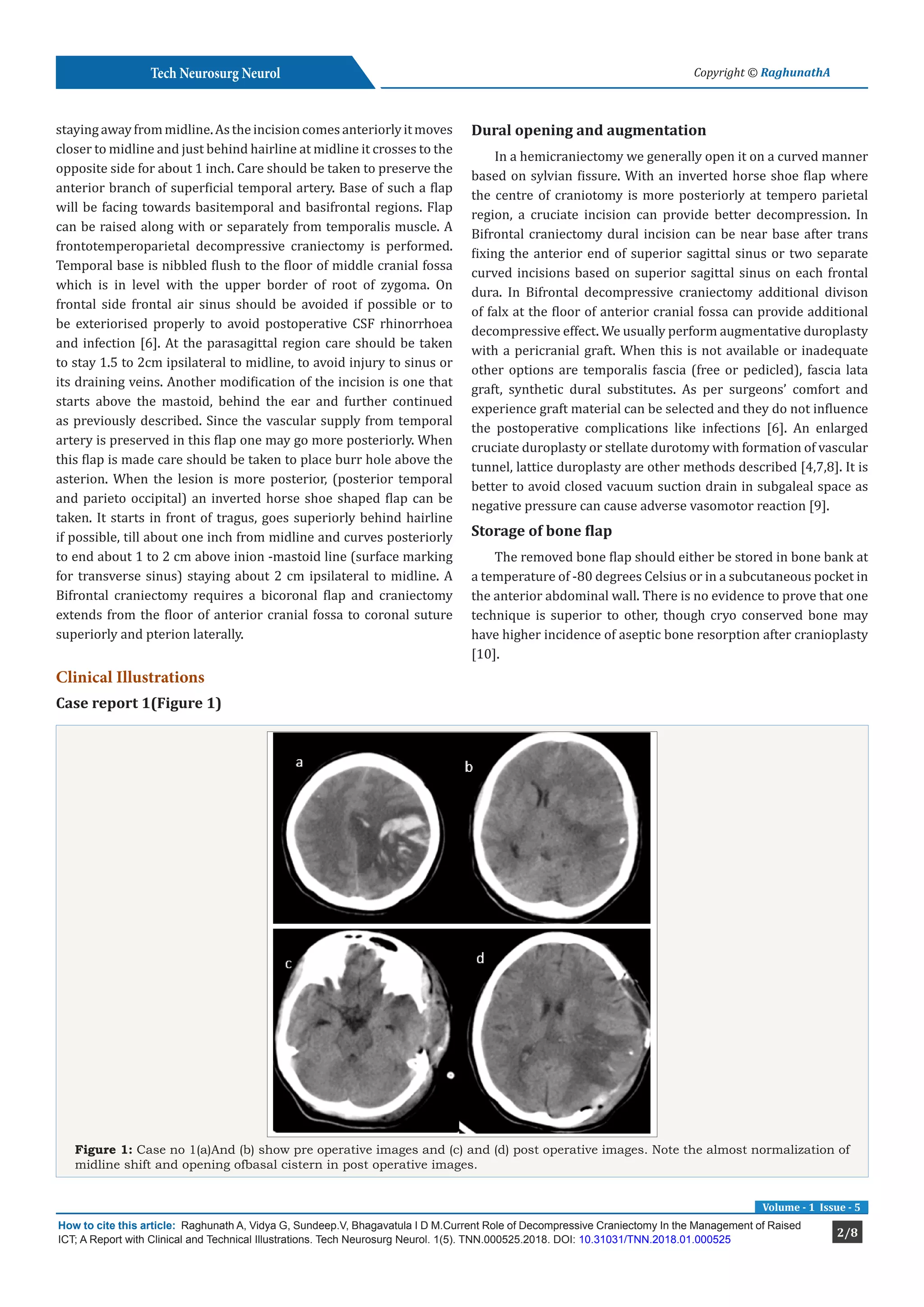 Current Role of Decompressive Craniectomy In the Management of Raised ...