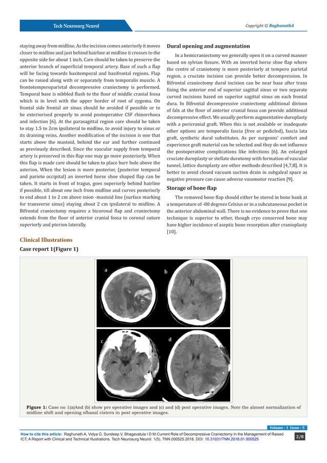 Current Role of Decompressive Craniectomy In the Management of Raised ...