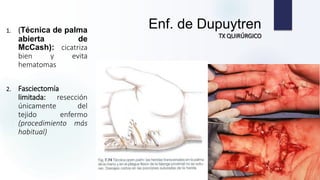 TENOSINOVITIS FLEXORA, DUPUYTREN QUERVAIN MVV.pptx