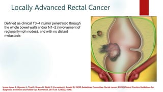 Total Neoadjuvant Therapy.pptx