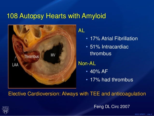 To amyloid and beyond