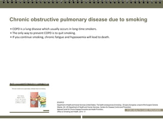Tobacco quit presentation. PPPTX. Quit | PDF