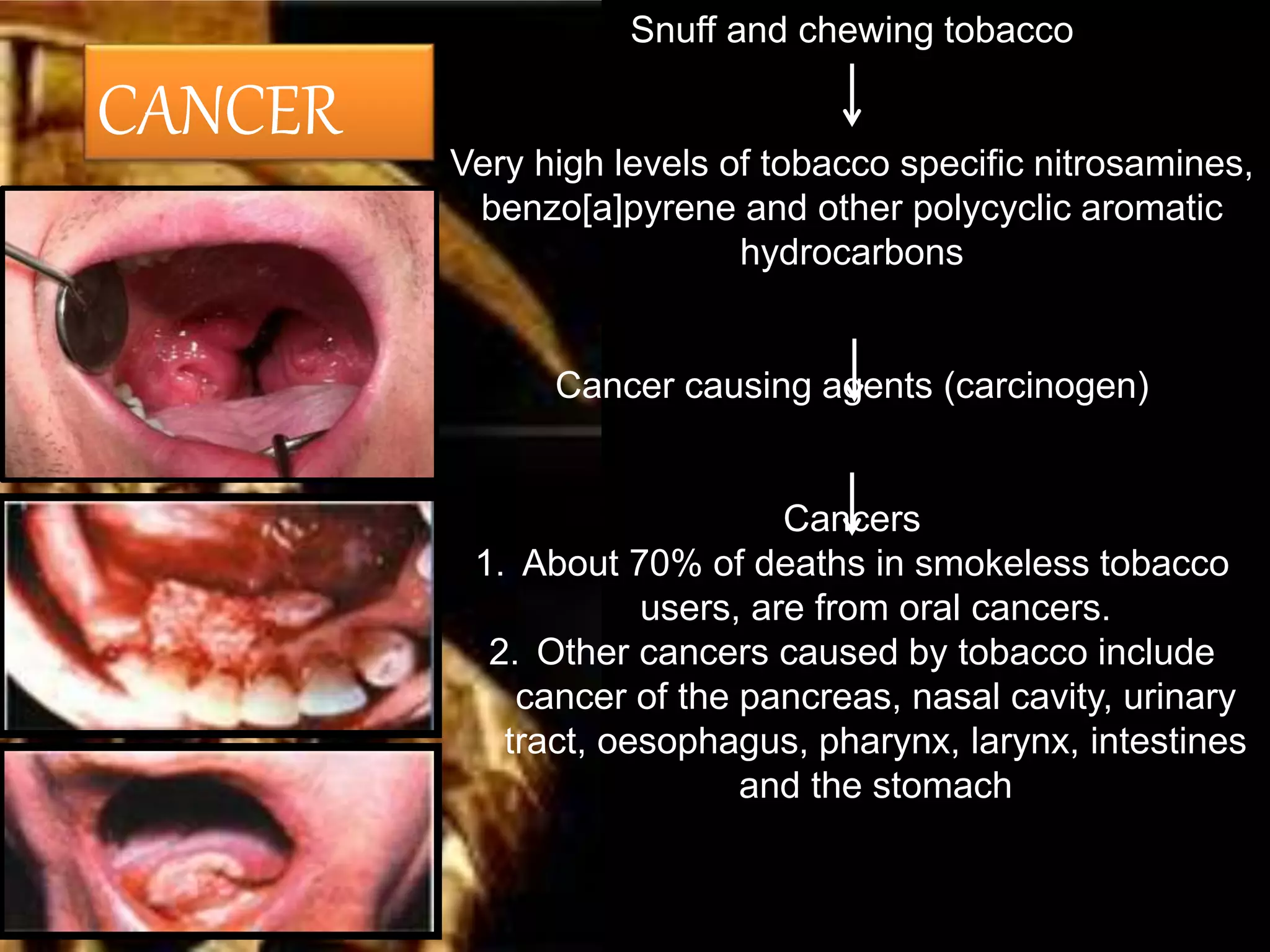 say no to tobacco | PPTX