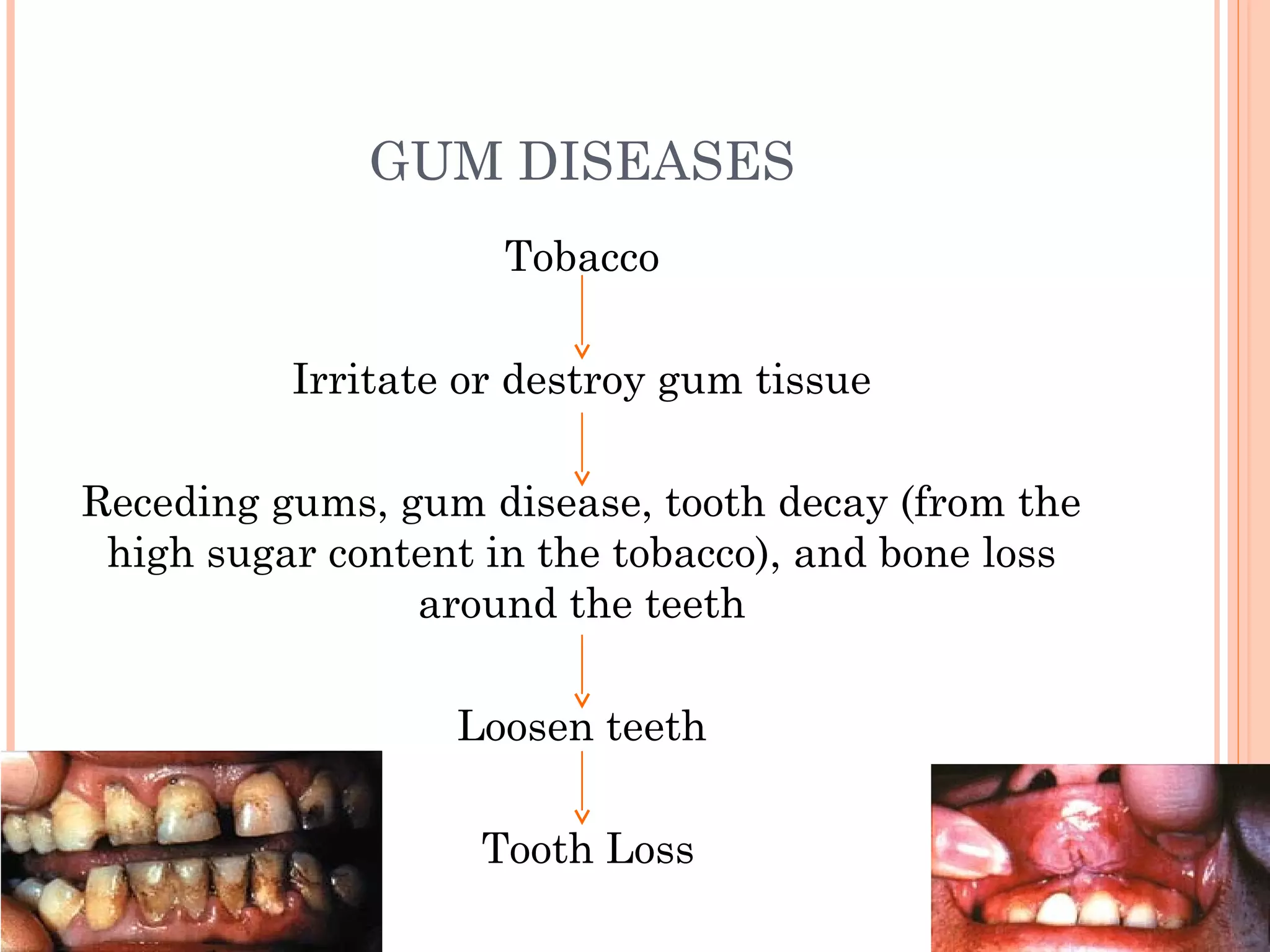 Harmful Health Effects of Tobacco consumption | PPT