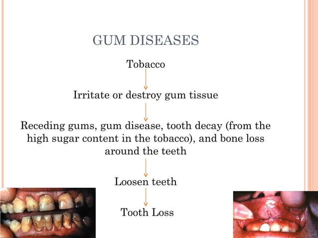 Harmful Health Effects of Tobacco consumption | PPT | Illegal Drugs ...
