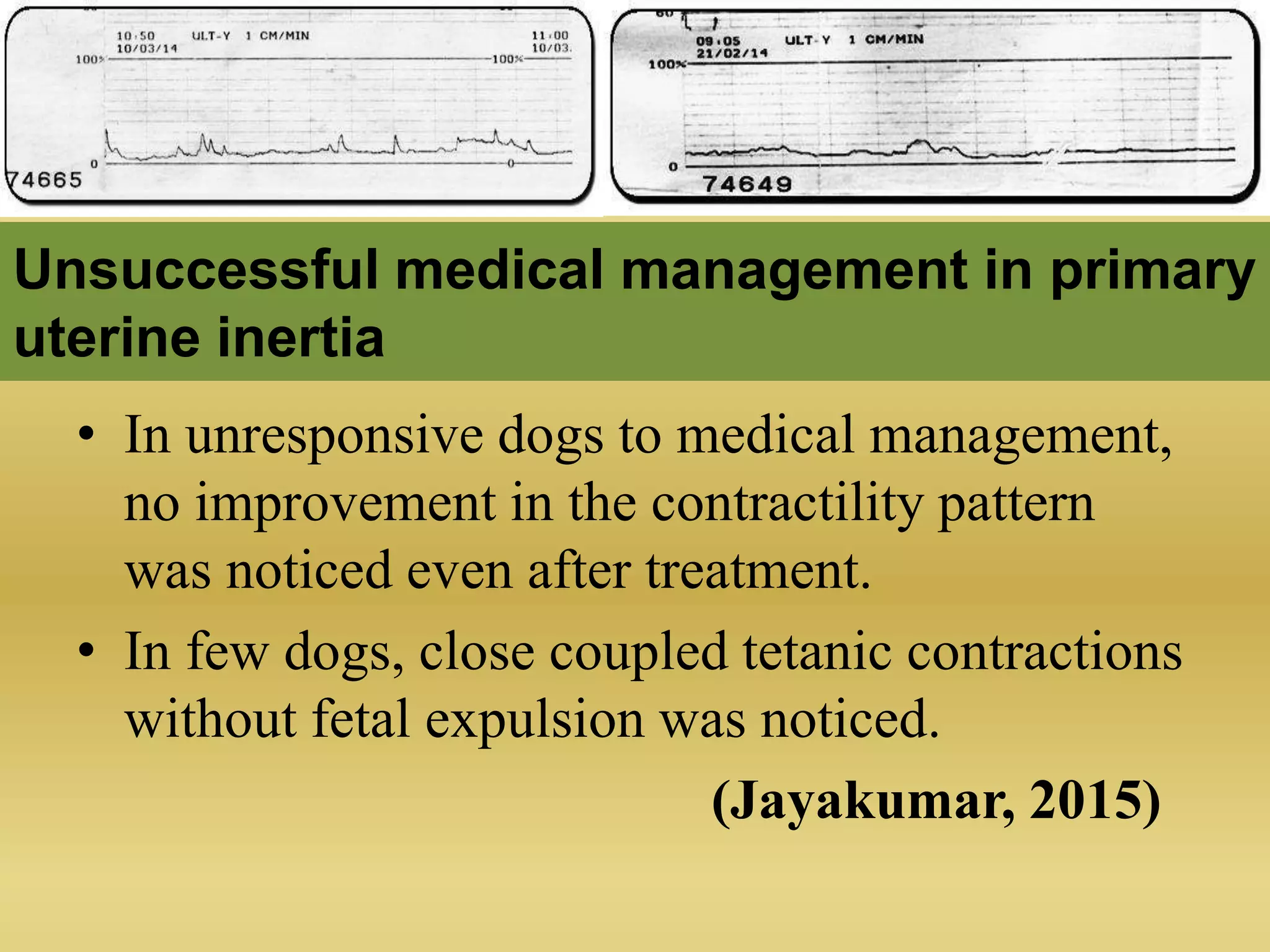 Tocodynamometer, cardiotocogram | PPTX