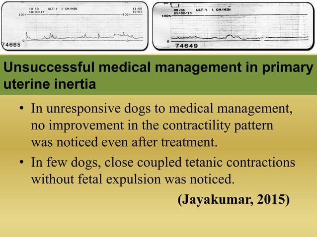 Tocodynamometer, cardiotocogram | PPTX
