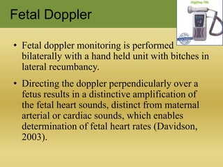 Tocodynamometer, cardiotocogram | PPT