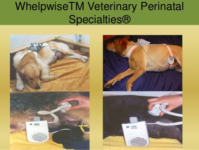 Tocodynamometer, cardiotocogram