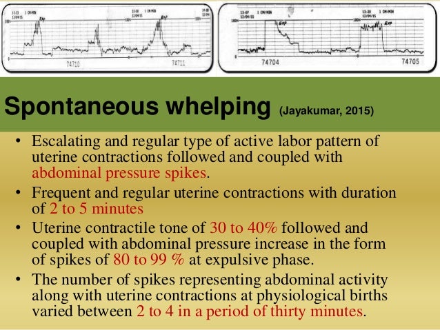 Tocodynamometer, cardiotocogram