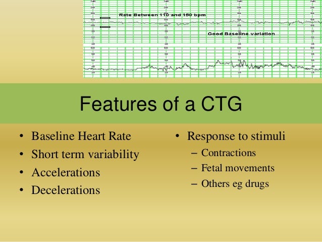 Tocodynamometer, cardiotocogram