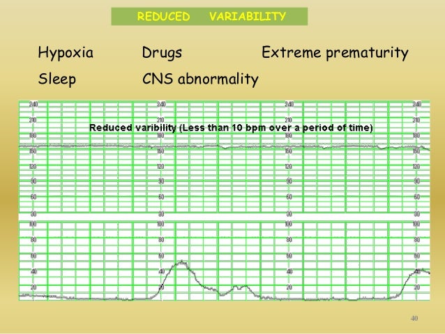 Tocodynamometer, cardiotocogram