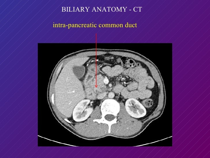 Imaging of Bile Duct - Columbia Asia Workshop