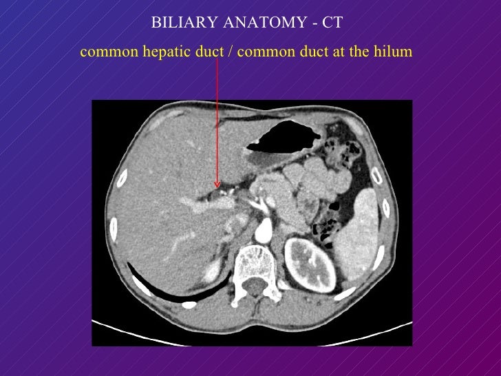 Imaging of Bile Duct - Columbia Asia Workshop