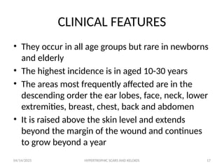 Hypertrophic scars and keloids............ | PPTX