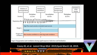 Optimise don’t compromise, peri-intubation physiology | PPTX