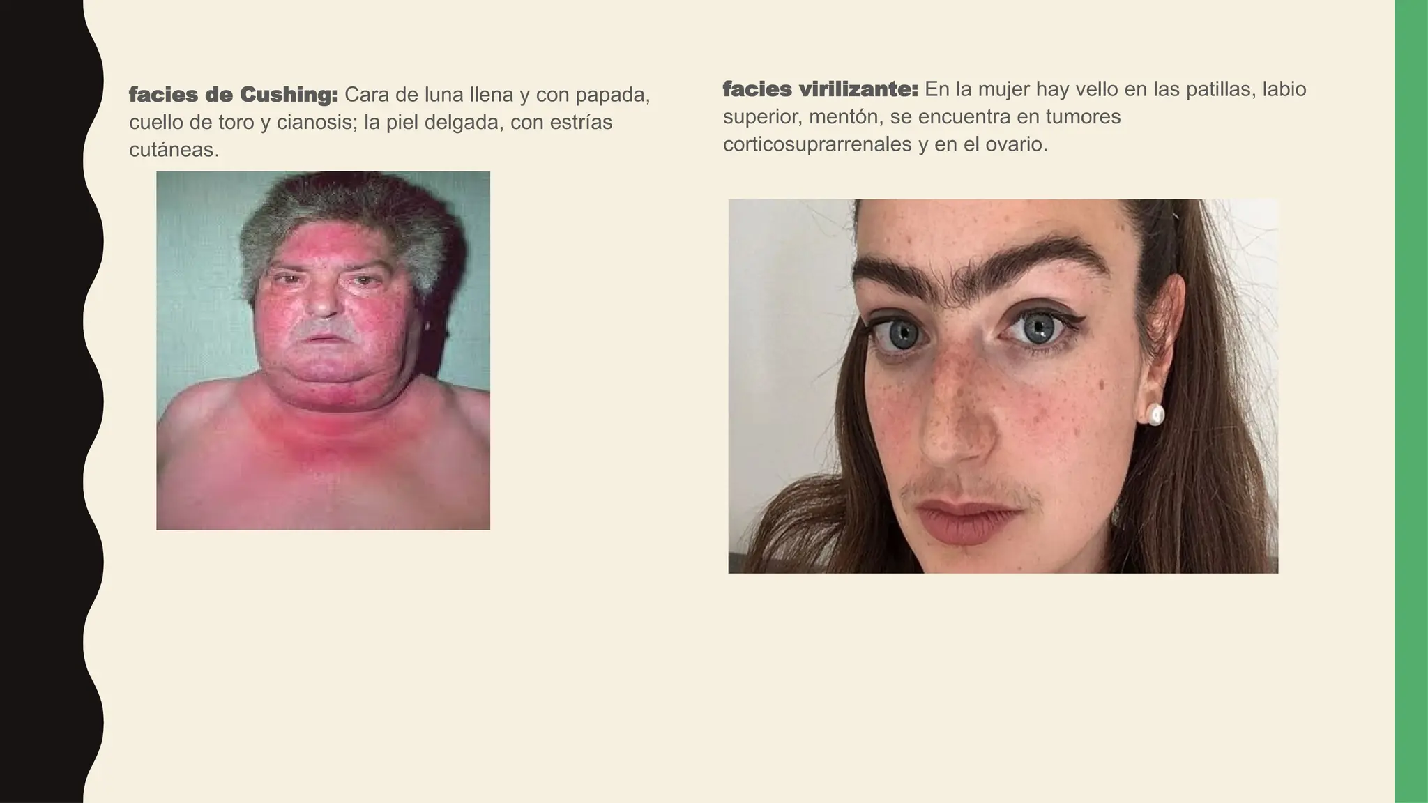 Todos los tipos de Facies y sus patologías | PPTX