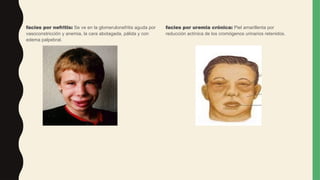 Todos los tipos de Facies y sus patologías | PPTX
