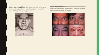 Todos los tipos de Facies y sus patologías | PPTX