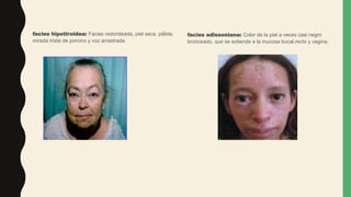 Todos los tipos de Facies y sus patologías | PPTX